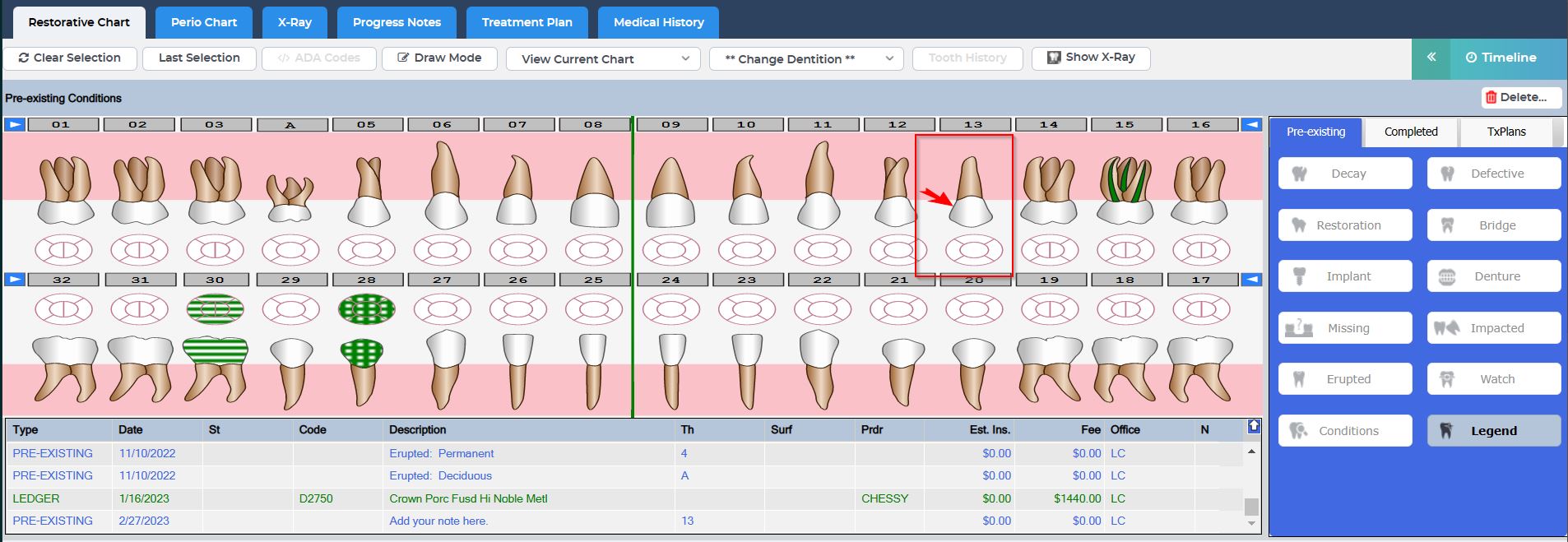 How do I add a "watch" to a tooth in the restorative chart? – Planet DDS
