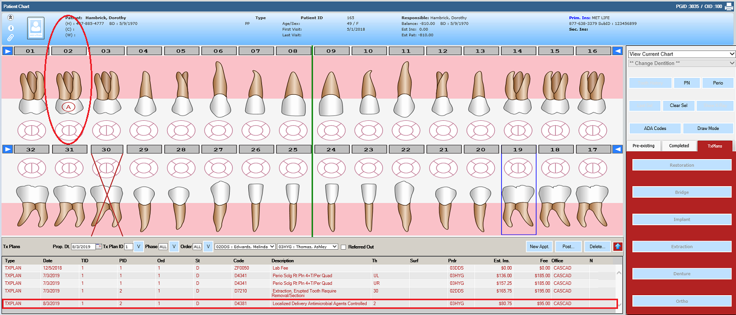 How can we modify the Arestin Code (D4381) default material so that it ...