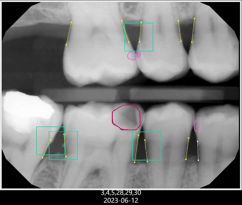 Pearl AI Overview – Planet DDS