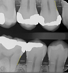 Pearl AI Overview – Planet DDS