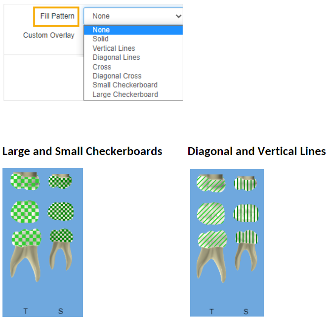Dental Chart - Charting – Planet DDS