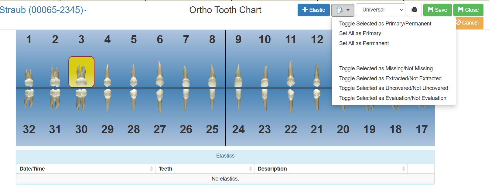 Using the Uncover and Evaluation Options from the Ortho Tooth Chart in ...